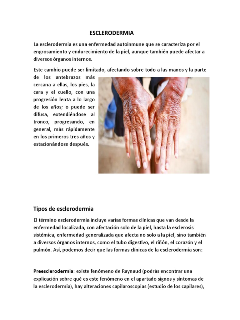 ESCLERODERMIA | PDF | Enfermedades y trastornos humanos | Inmunología