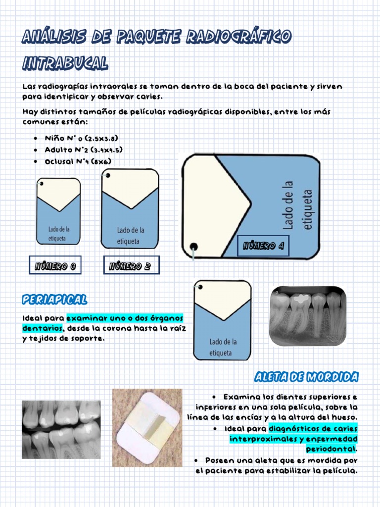 Análisis de Paquete Radiográfico | PDF
