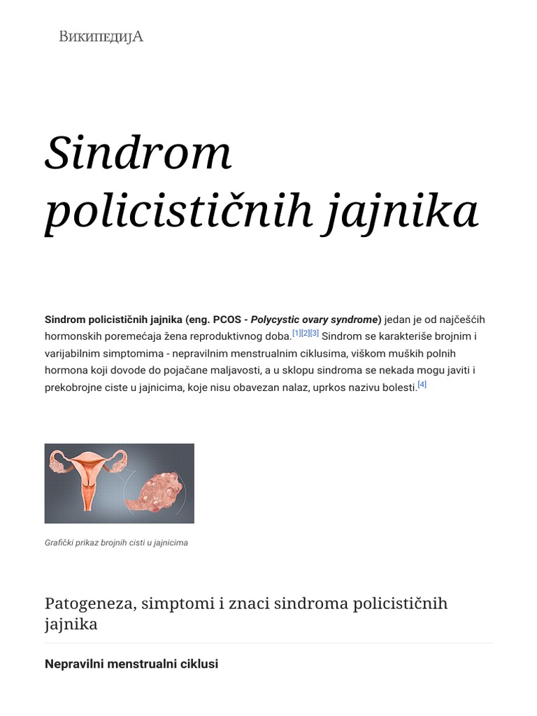 Sindrom policističnih jajnika - Википедија | PDF