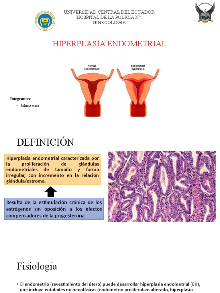 Hiperplasia Endometrial | PDF | Especialidades Medicas | Medicina CLINICA