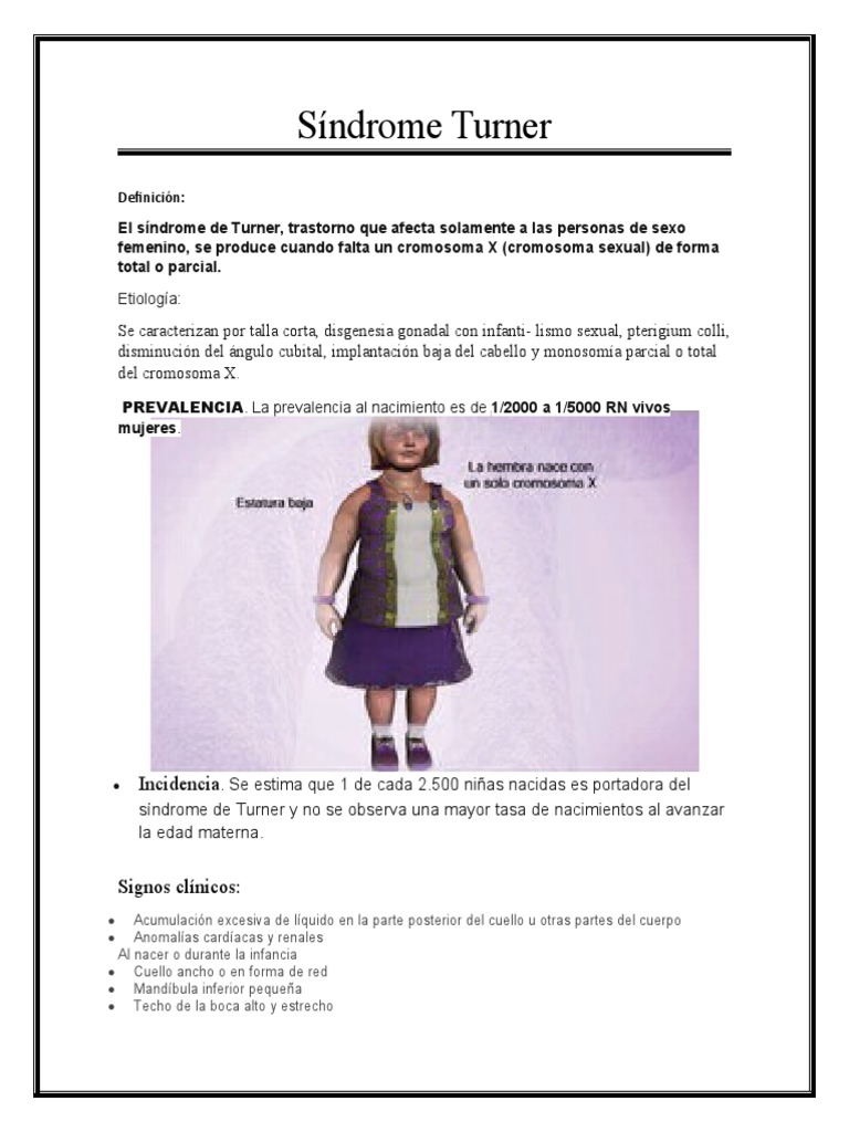 Síndrome Turner | PDF