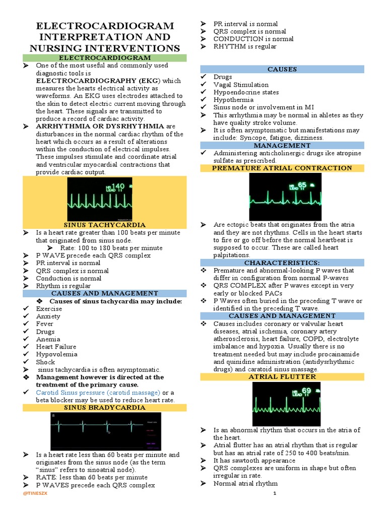 ELECTROCARDIOGRAM-INTERPRETATION-AND-NURSING-INTER | PDF ...