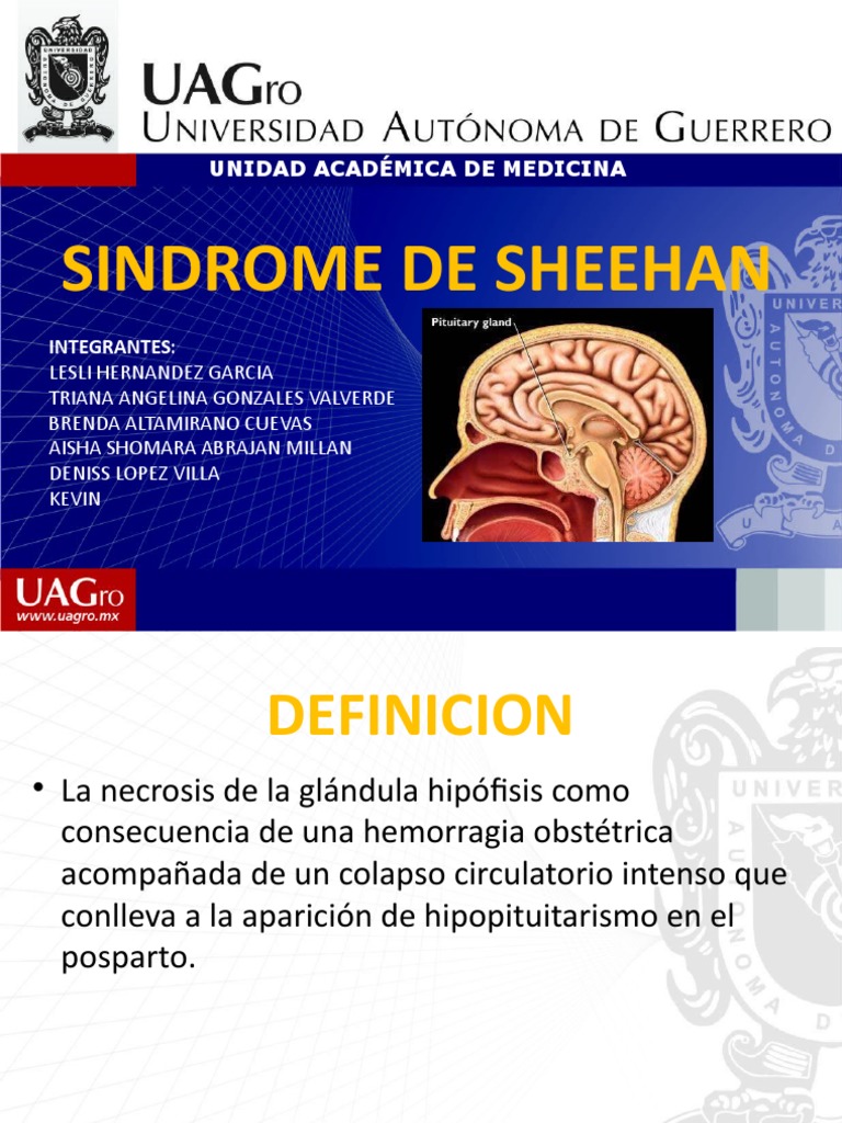 Sindrome de Sheehan Endocrino | PDF | Glándula pituitaria | Periodo ...