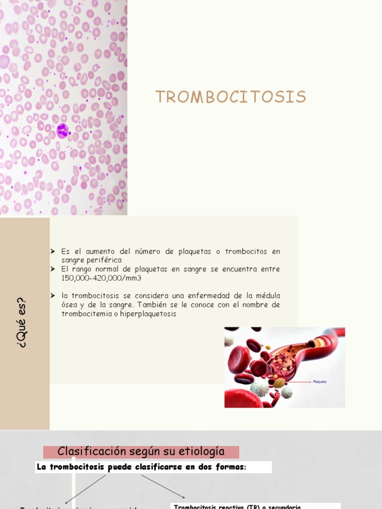 TROMBOCITOSIS 2022pptx | PDF | Plaqueta | Anemia