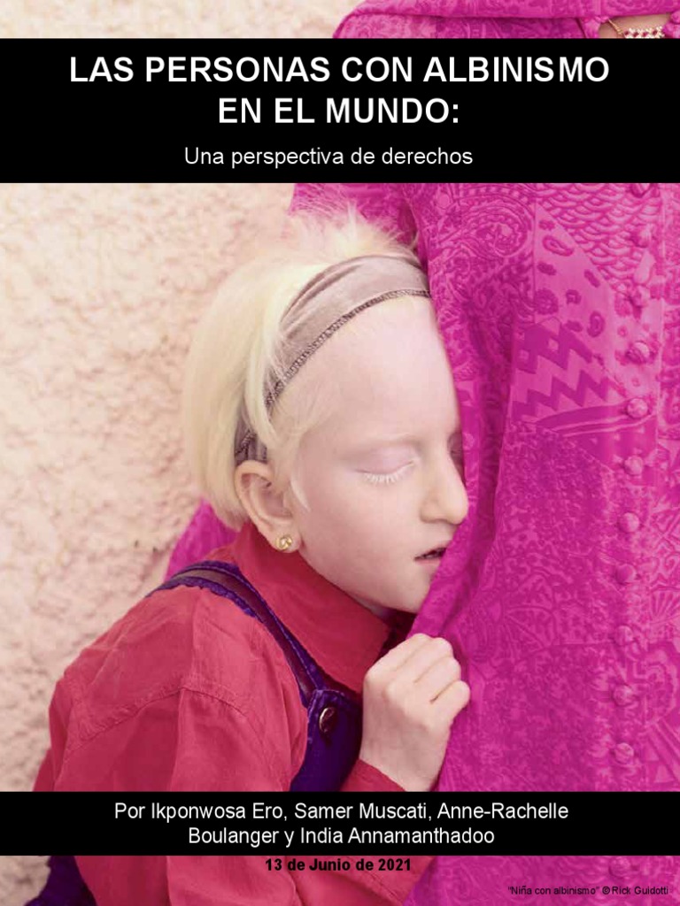 Las Personas Con Albinismo en El Mundo: Una Perspectiva de Derechos ...