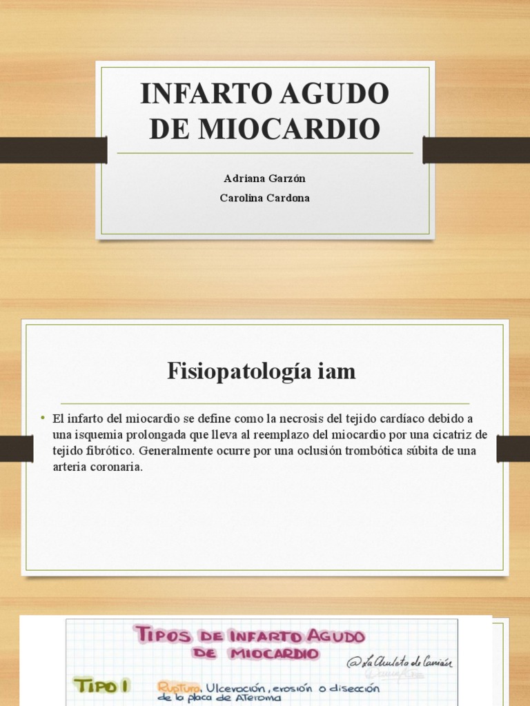 Fisiopatología del Infarto Agudo de Miocardio | PDF | Infarto de ...