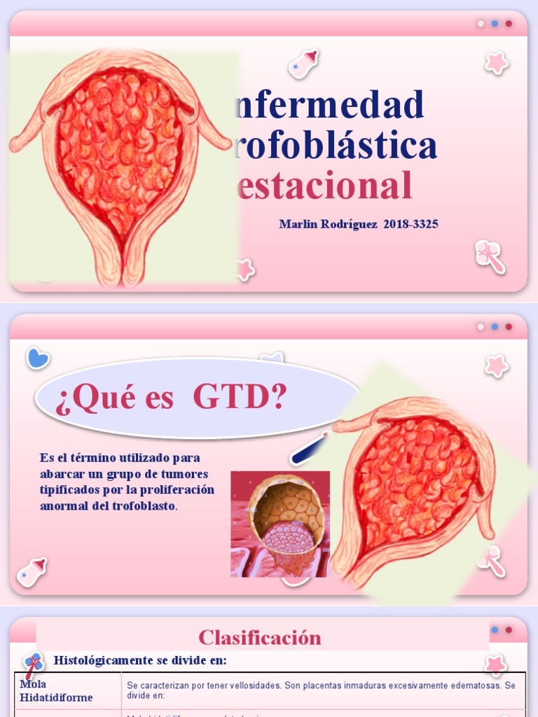 Teo. Enfermedad Trofoblástica Gestacional | PDF | Enfermedades y ...