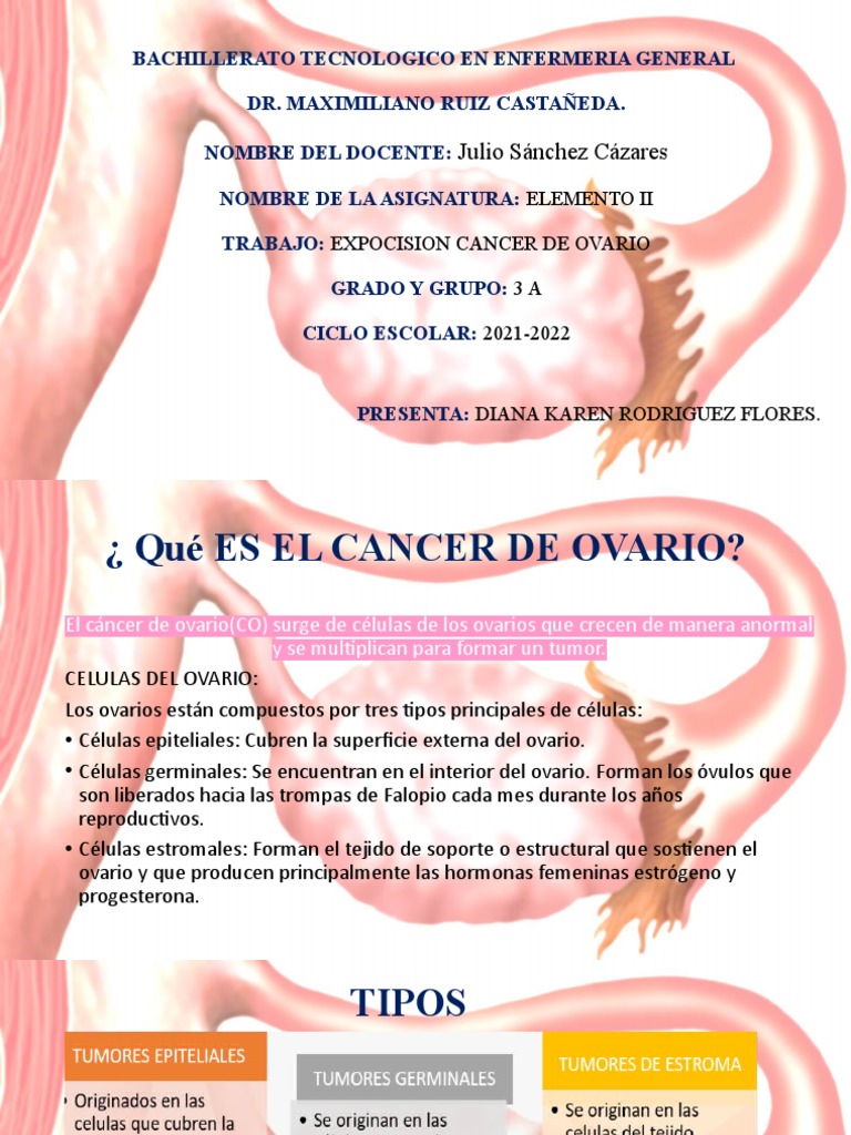 Cancer de Ovario | Descargar gratis PDF | Ovario | Cáncer