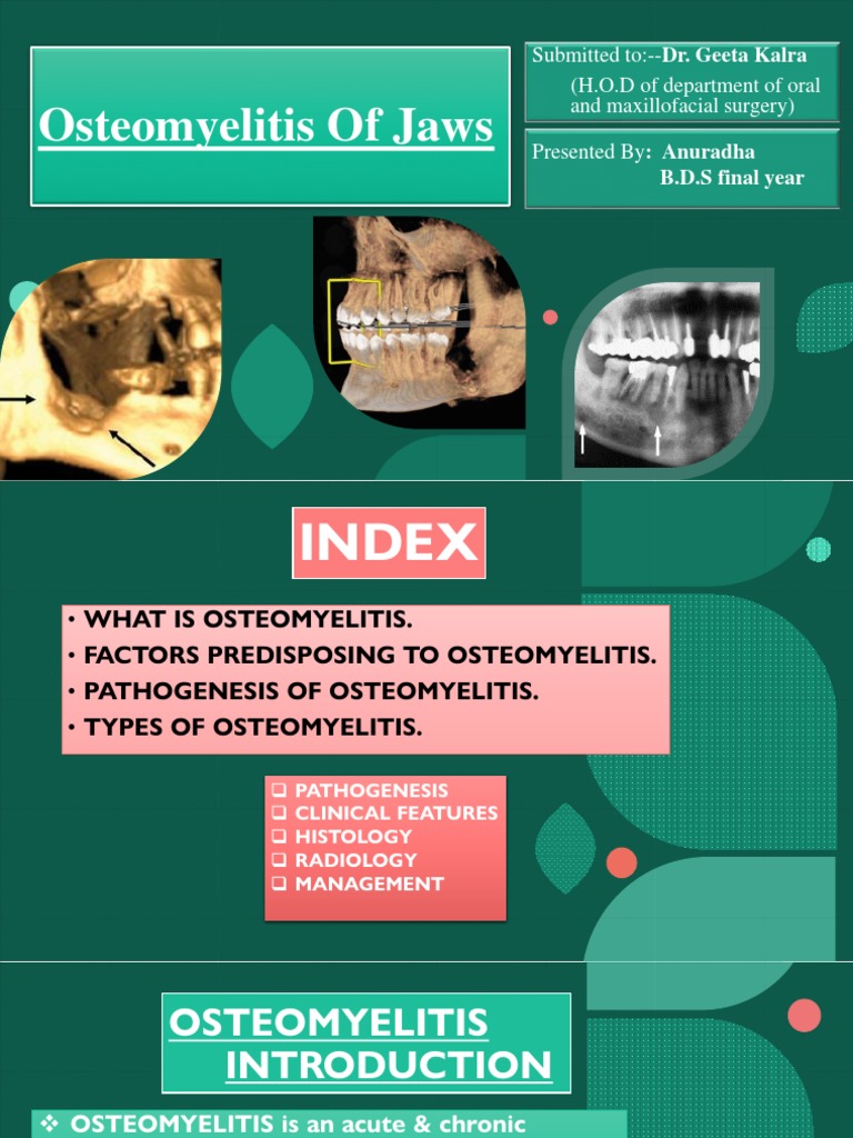 Osteomyelitis of Jaws | PDF | Health Sciences | Medicine