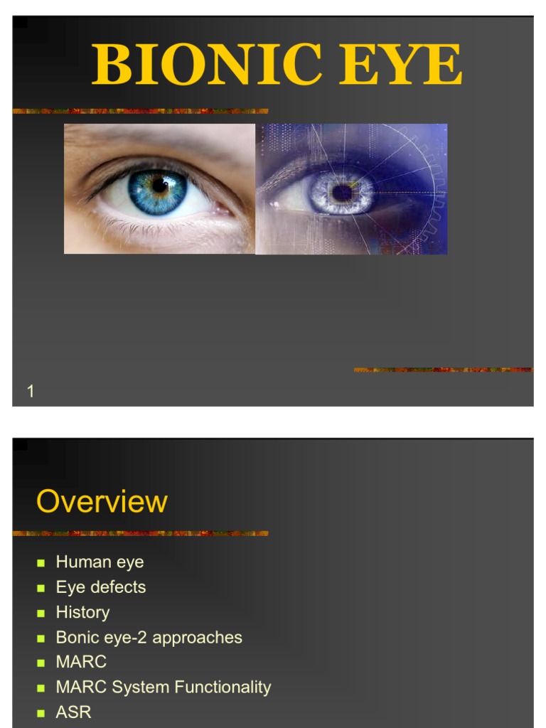 Bionic-eye Org PPT | Retina | Electromagnetism
