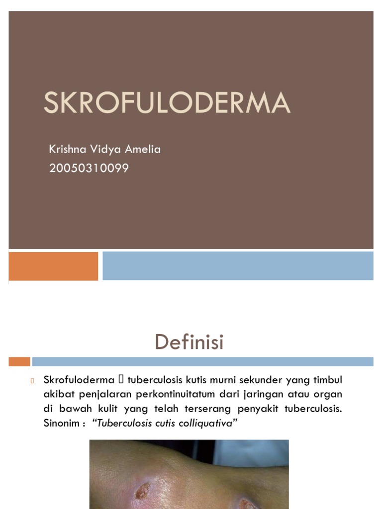 Skrofuloderma (RPS) | PDF