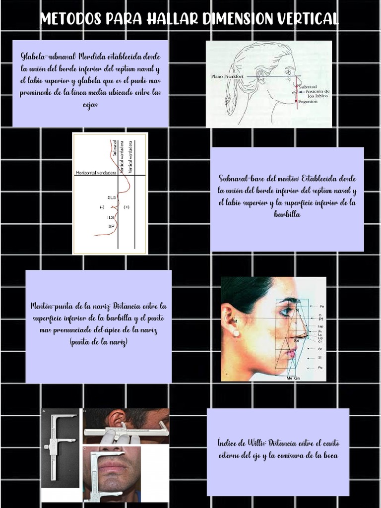 Métodos para Hallar Dimensión Vertical | PDF