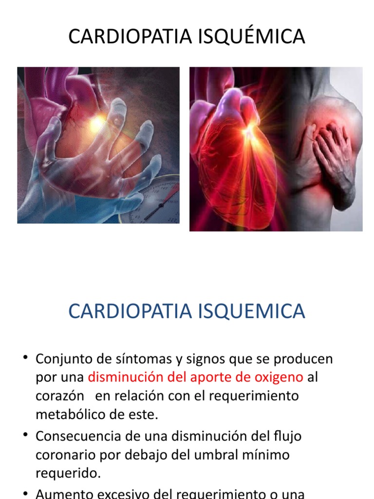 Cardiopatía Isquémica: Causas y Manejo | PDF | Isquemia | Infarto de ...