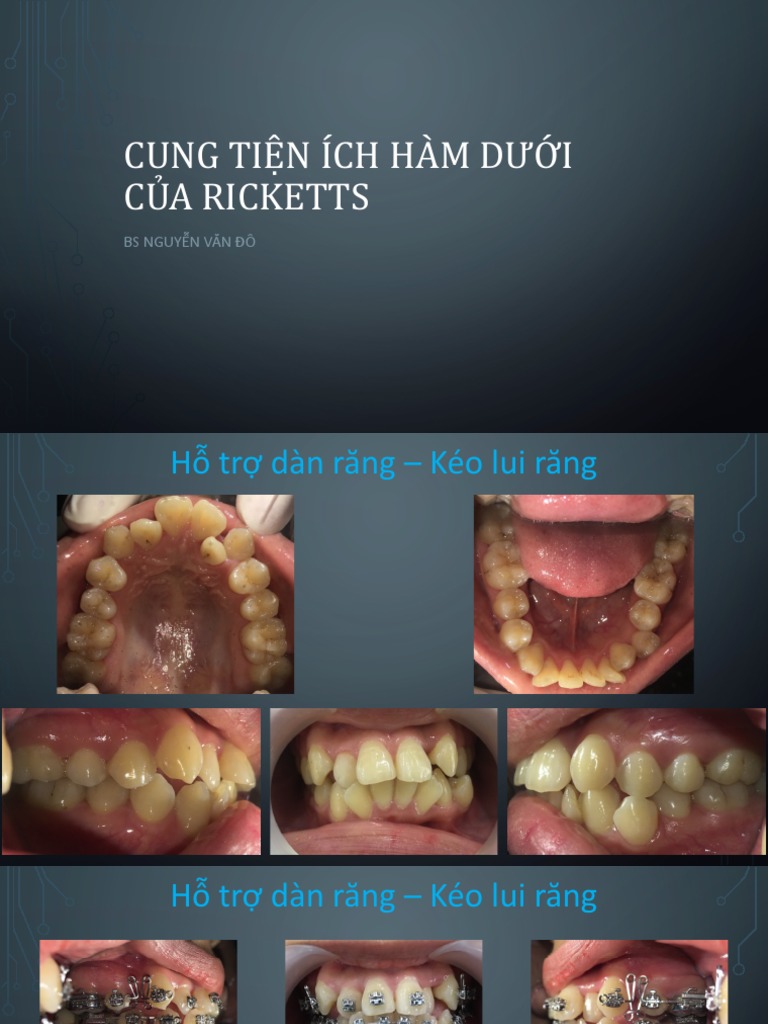 (Module 1) Cung tiện ích | PDF