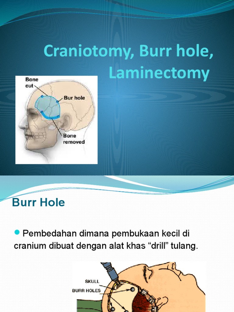 Craniotomy, Burr Hole, Laminectomy | PDF