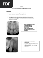 Canino Temporal Superior | PDF | Anatomia dental | Diente