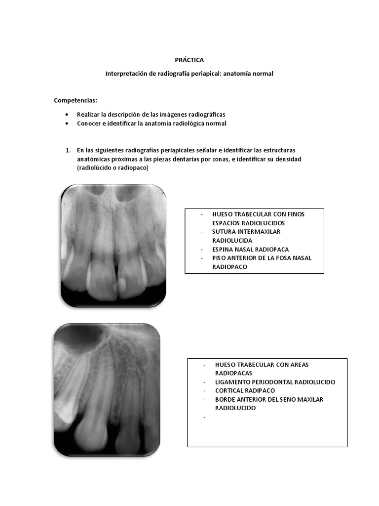 Interpretación de Radiografías Periapicales | PDF | Hueso | Diente