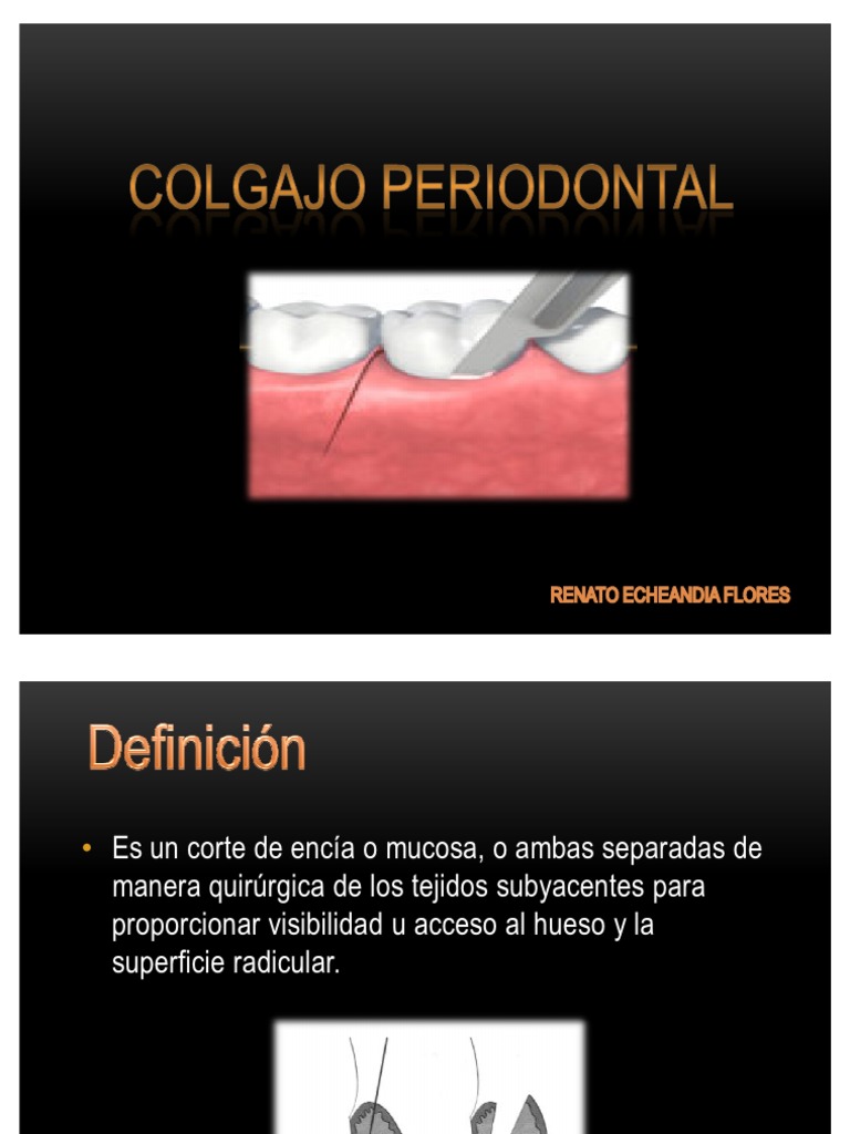 Colgajo Periodontal | PDF