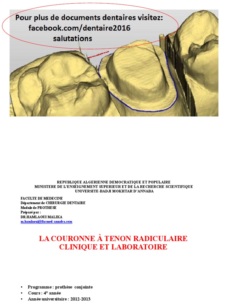 Couronne Richmond à Tenon Radiculaire | PDF