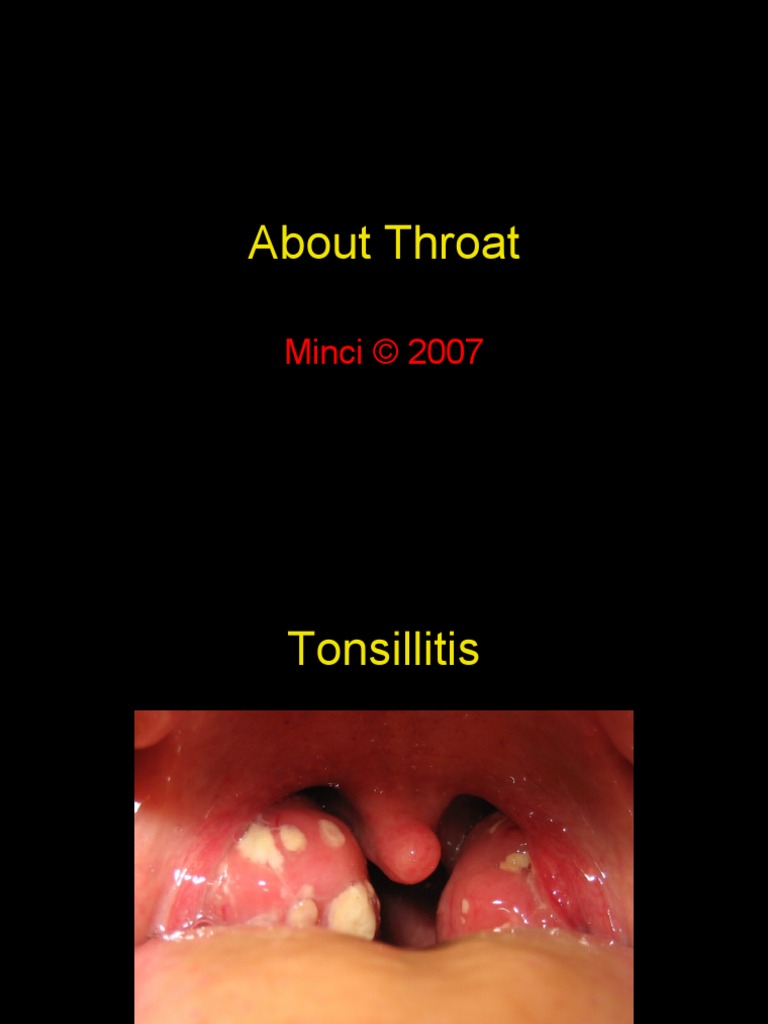 Throat Powerpoint | Medical Specialties | Diseases And Disorders