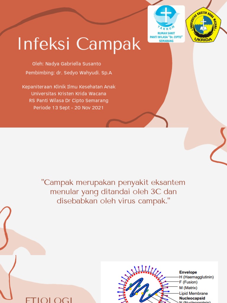 Referat Campak | PDF
