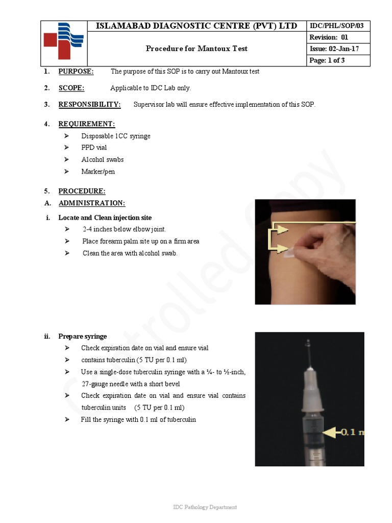 03. Procedure for Mantoux Test | PDF | Clinical Medicine | Medicine
