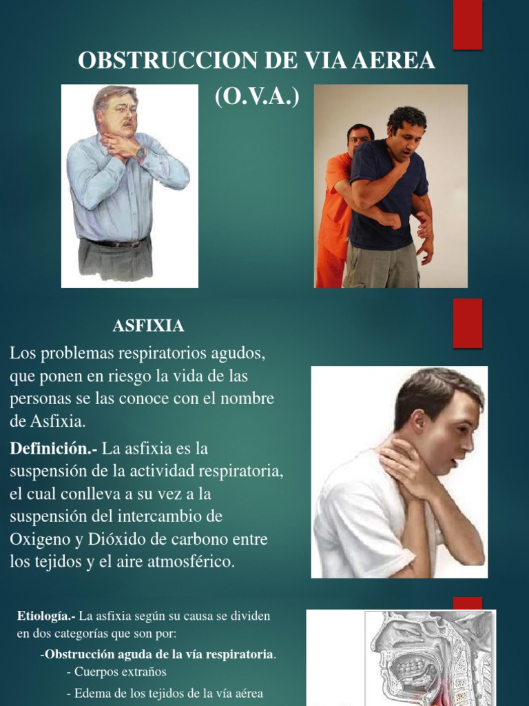 Tema 2 Obstruccion de Via Aerea | PDF | Anatomía | Fisiología