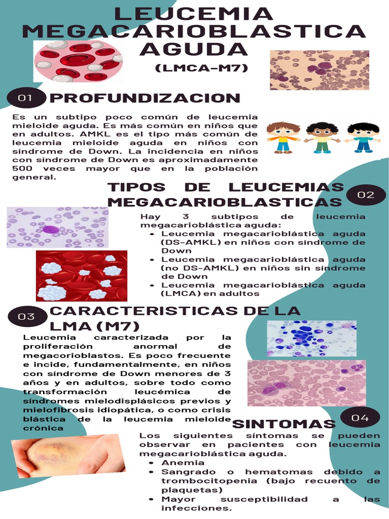Equipo 8 (Hematopatologia) Leucemia Megacarioblastica Aguda | PDF | Leucemia | Sangre