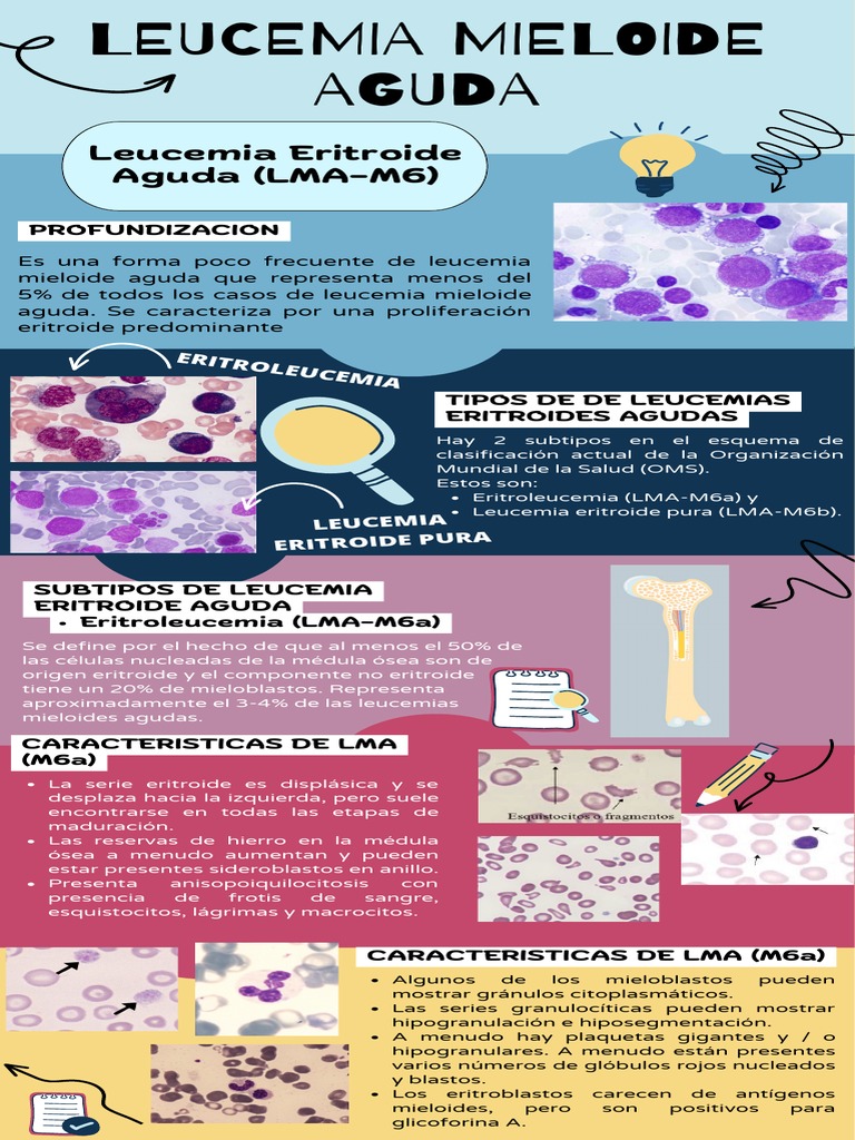 Equipo 8 (Hematopatologia) Leucemia Mieloide Aguda | PDF | Leucemia ...