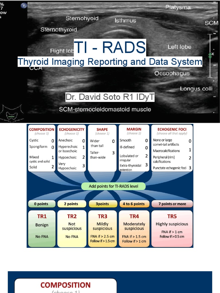 TI - RADS (Revision) | PDF