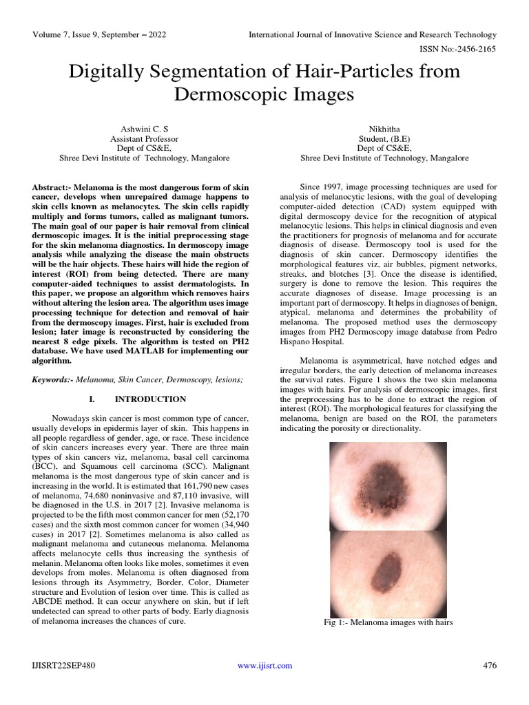 Digitally Segmentation of Hair-Particles From Dermoscopic Images | PDF | Skin Cancer | Melanoma