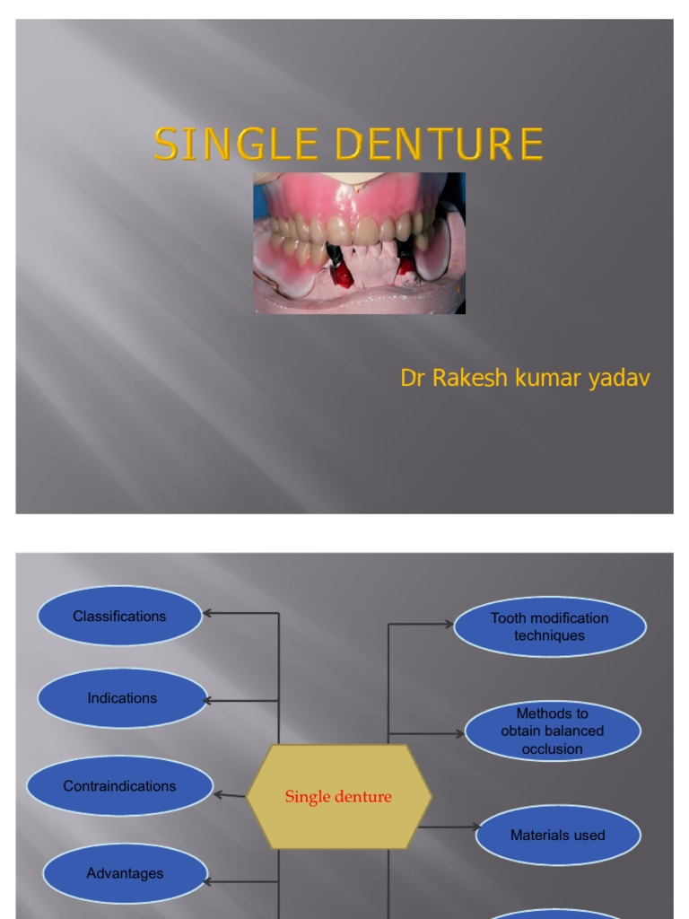 Rak Single Denture | PDF | Dentures | Human Tooth