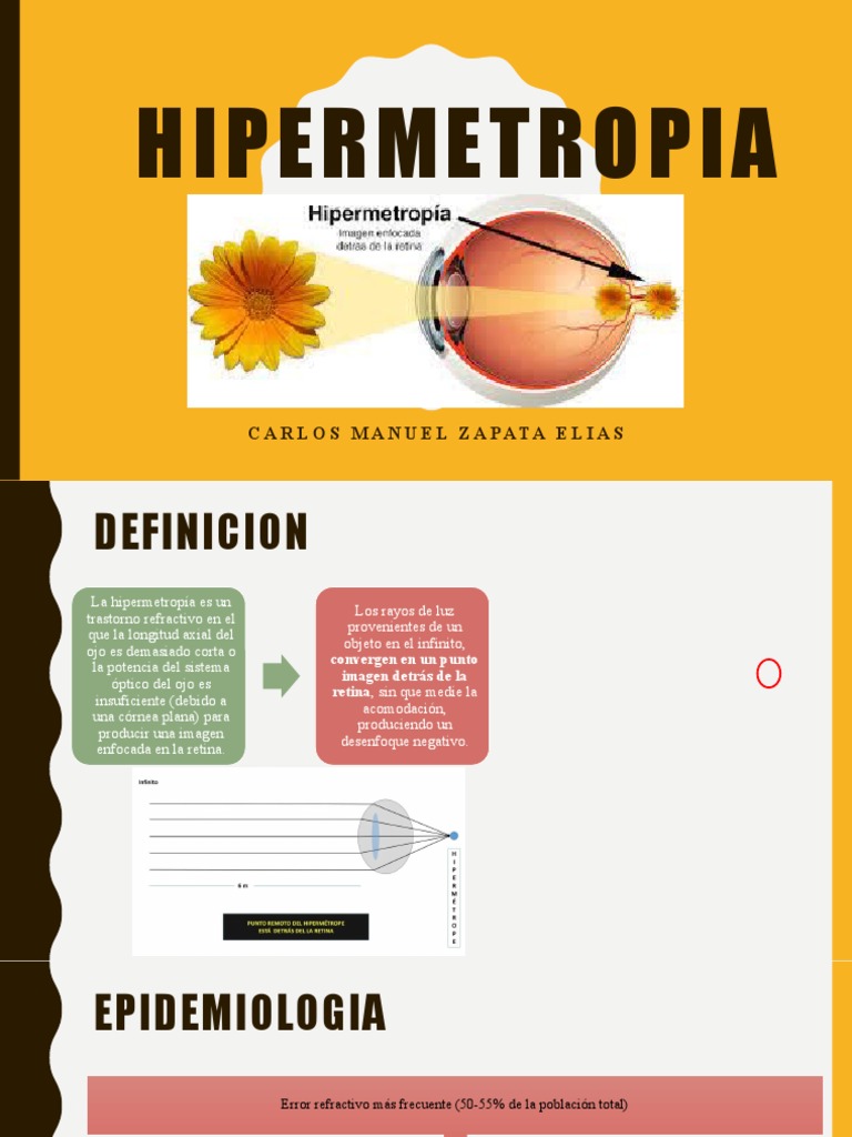 Hi Per Metro Pia | PDF | Ojo humano | Oftalmología