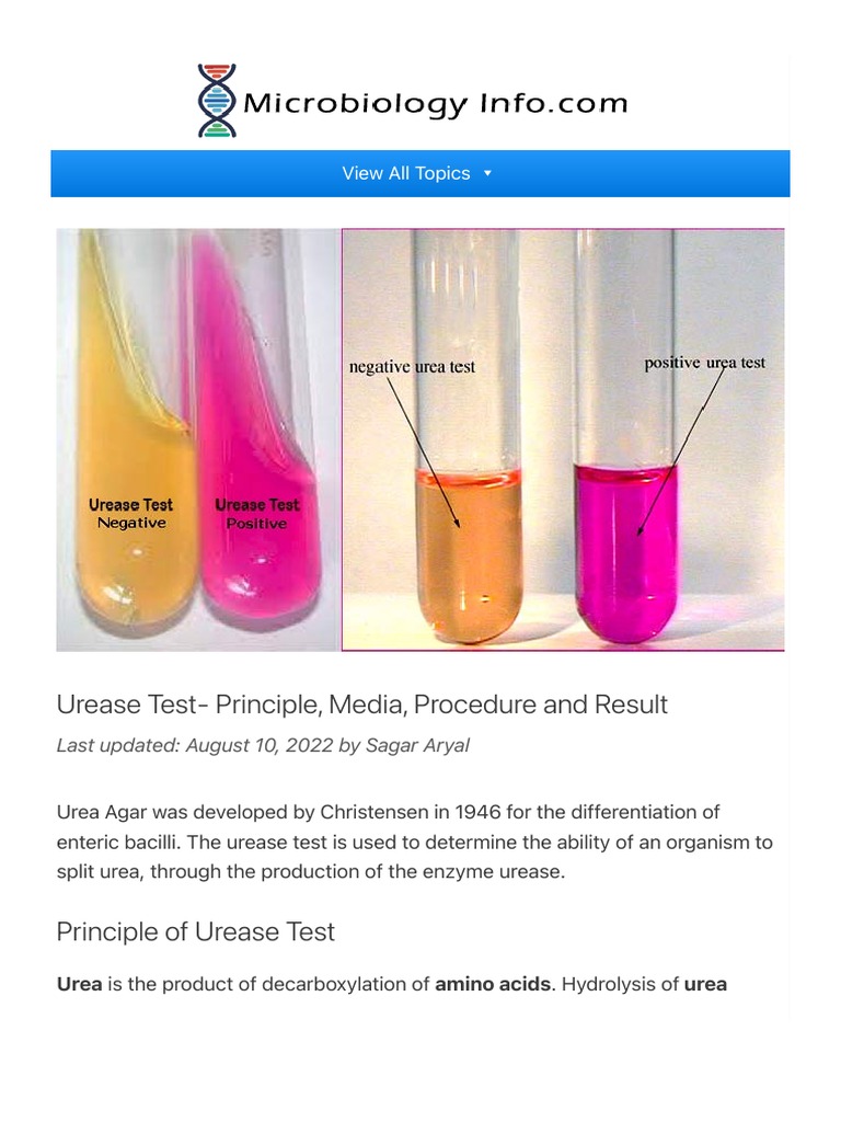 Urease Test - Principle, Media, Procedure and Result | PDF | Clinical ...