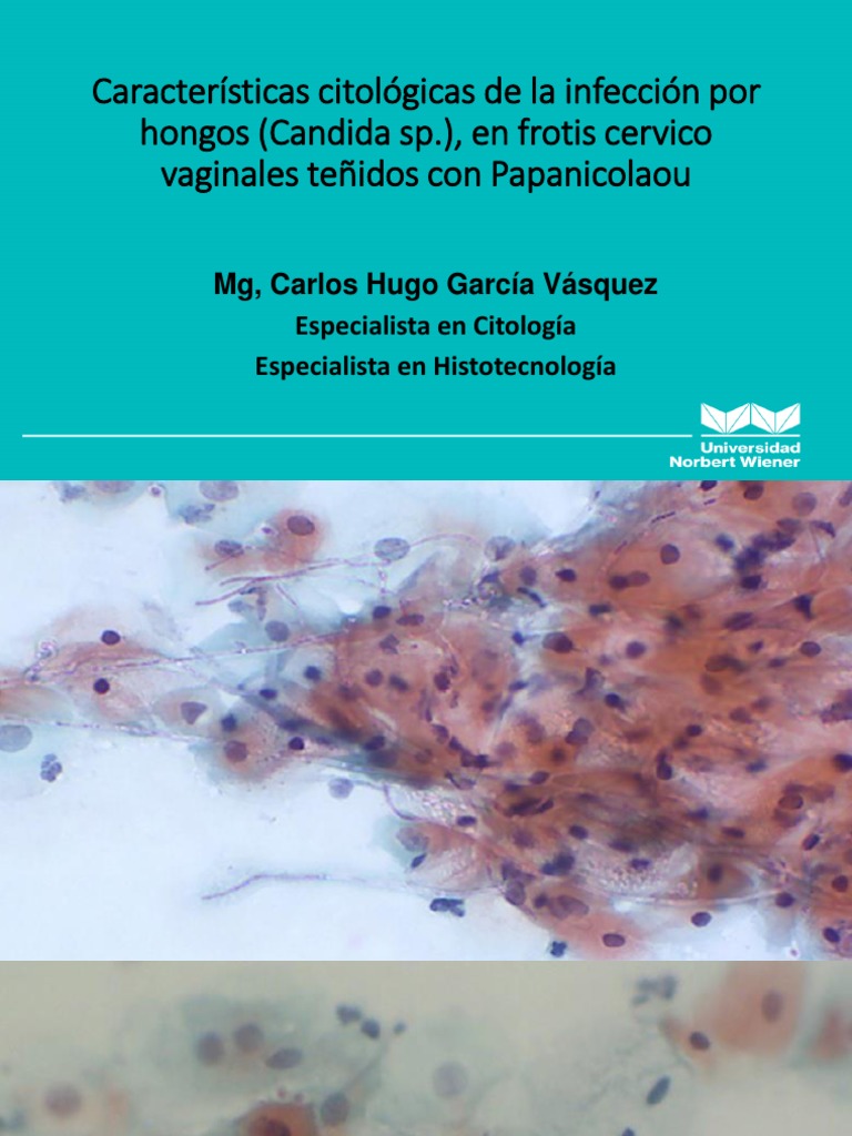 CANDIDA | PDF