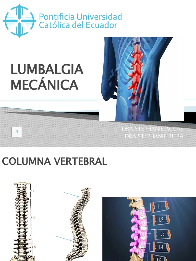 Lumbalgia Mecanica | PDF | Dolor lumbar | Ciencias de la Salud
