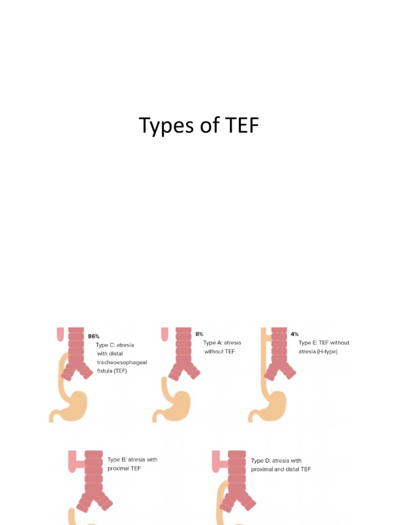 Types of TEF | PDF