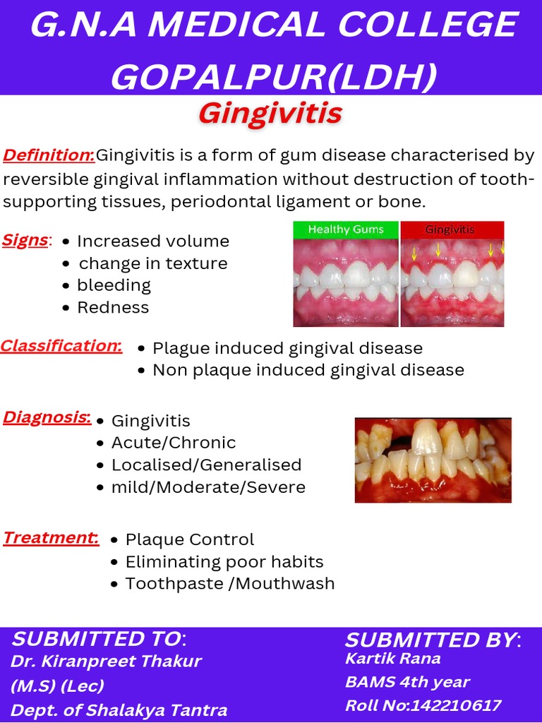 Gingivitis | PDF