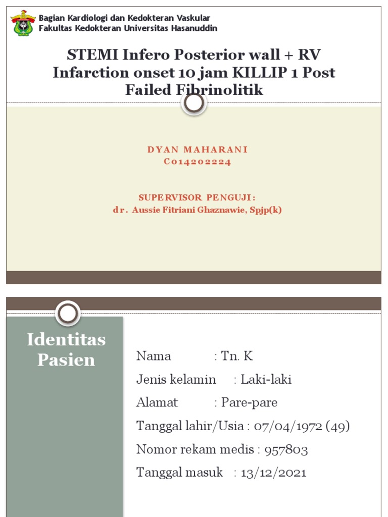STEMI Inferior Posterior | PDF