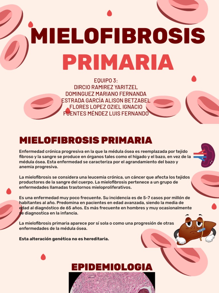 Mielofibrosis Primaria | PDF