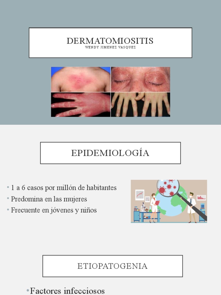 Signo de Gottron | PDF