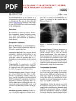Modified Radical Neck Dissection Steps | PDF | Common Carotid Artery | Neck