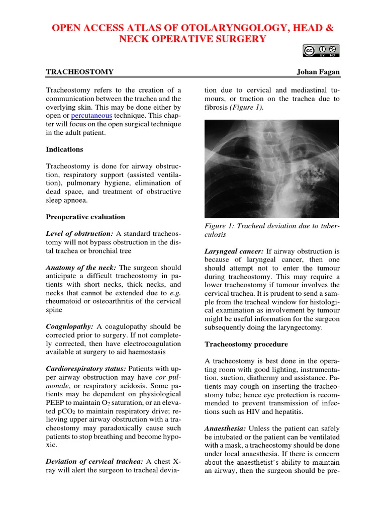 Tracheostomy | PDF | Human Anatomy | Anatomy