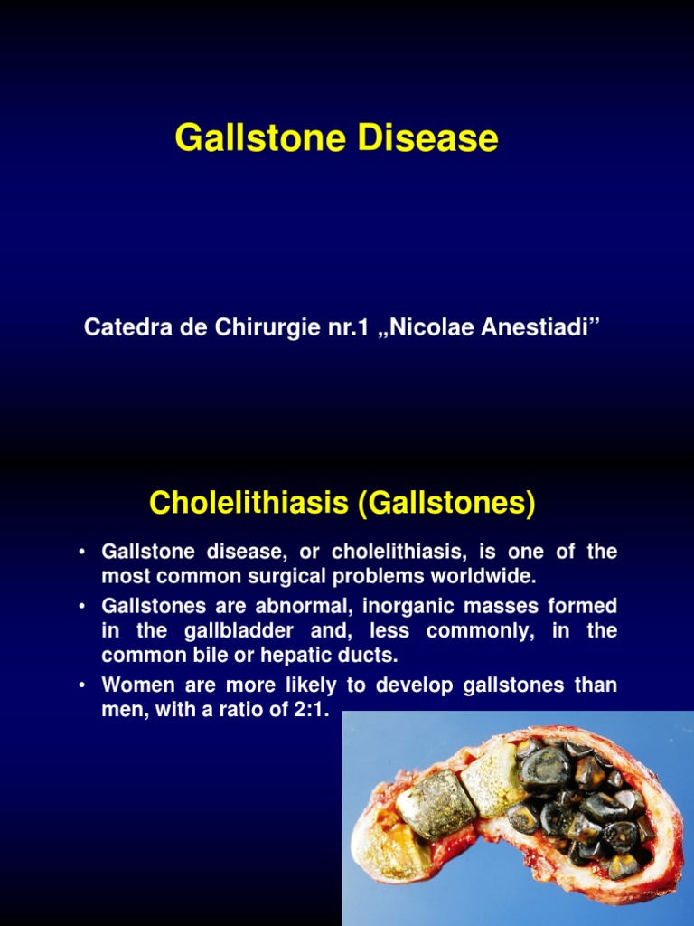 Gallstone Disease | PDF | Gallbladder | Bile
