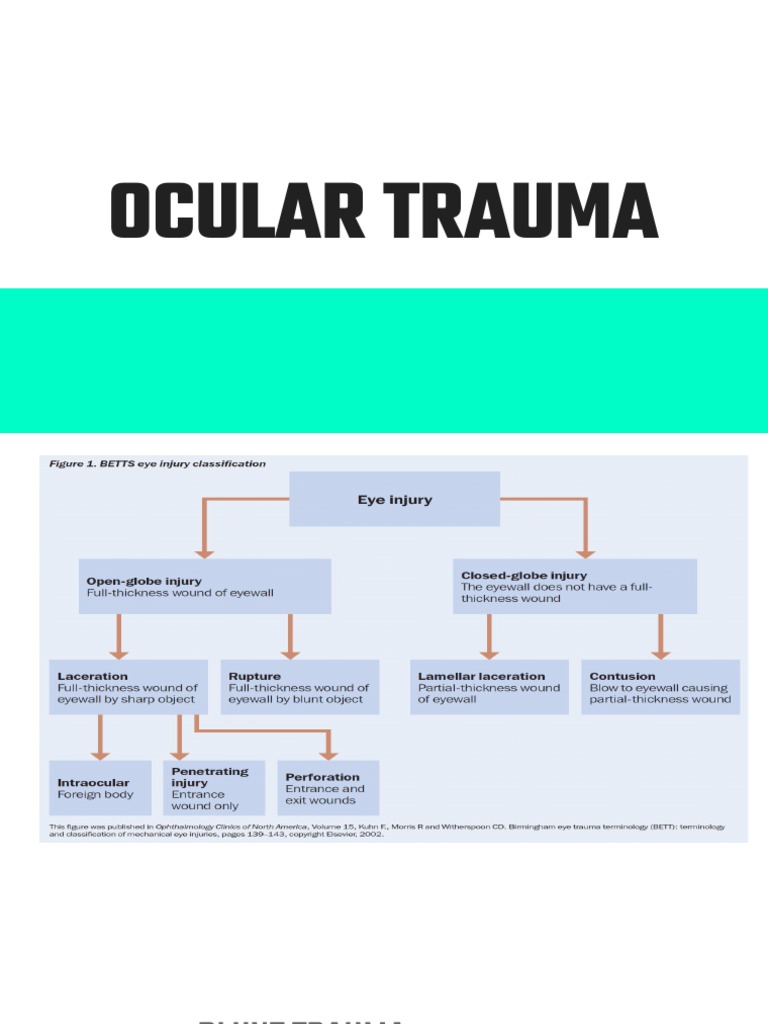 Ocular Trauma | PDF | Cataract | Human Eye
