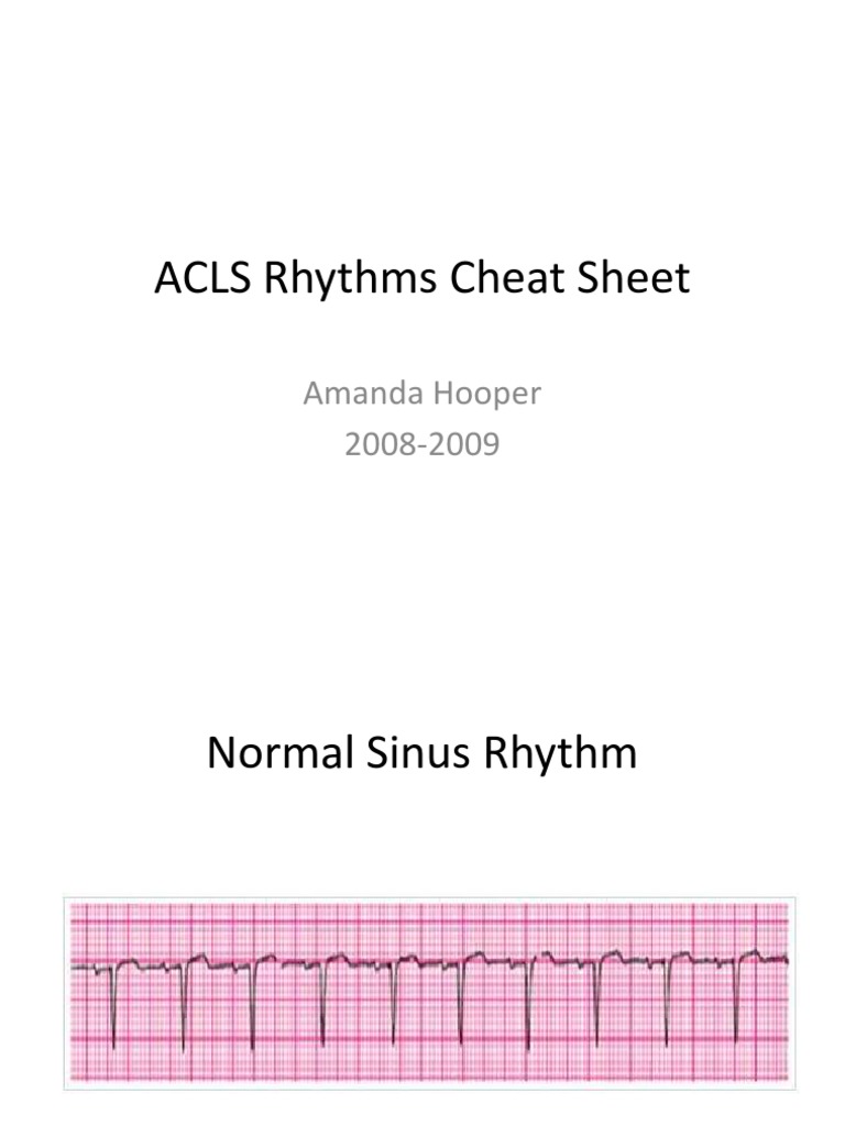 ACLS Rhythms Cheat Sheet: A Concise Guide to Common Cardiac Rhythms and ...