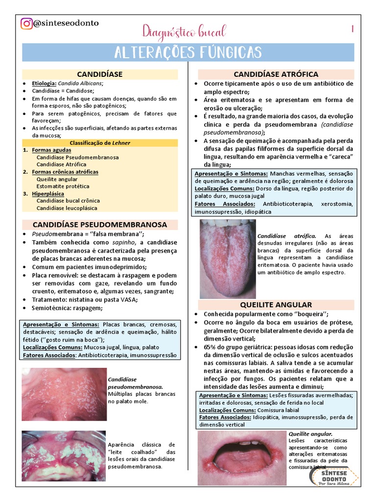 Alterações Fúngicas - @sinteseodonto | PDF | Candidíase | Boca
