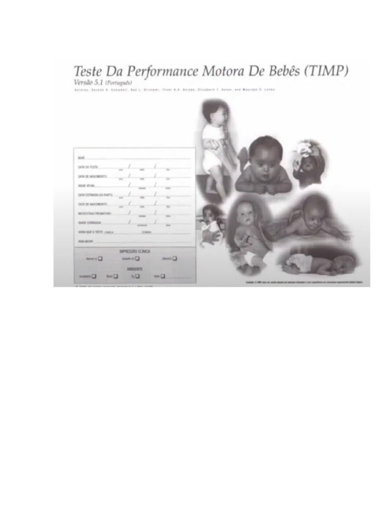 Escala Timp | PDF