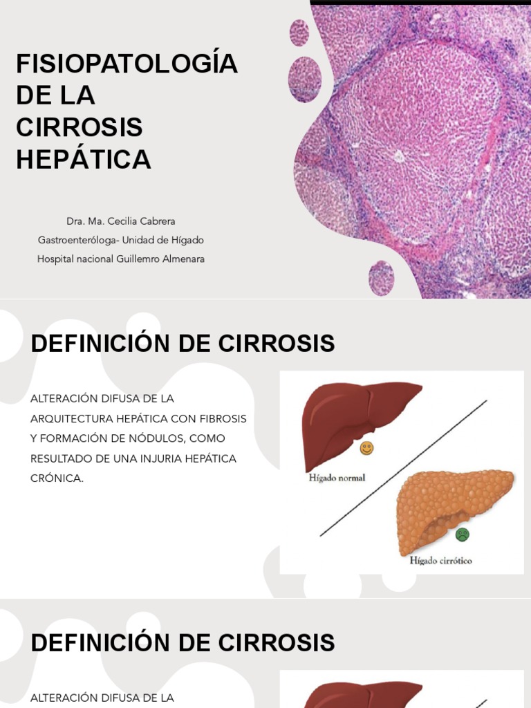 Fisiopatología de Cirrosis Hepática | PDF | Cirrosis | Hepatocito