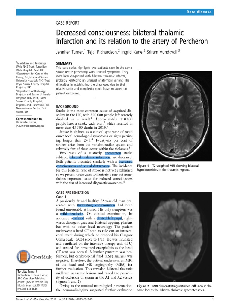 Decreased Consciousness Bithalamic Infarc | PDF | Thalamus | Stroke